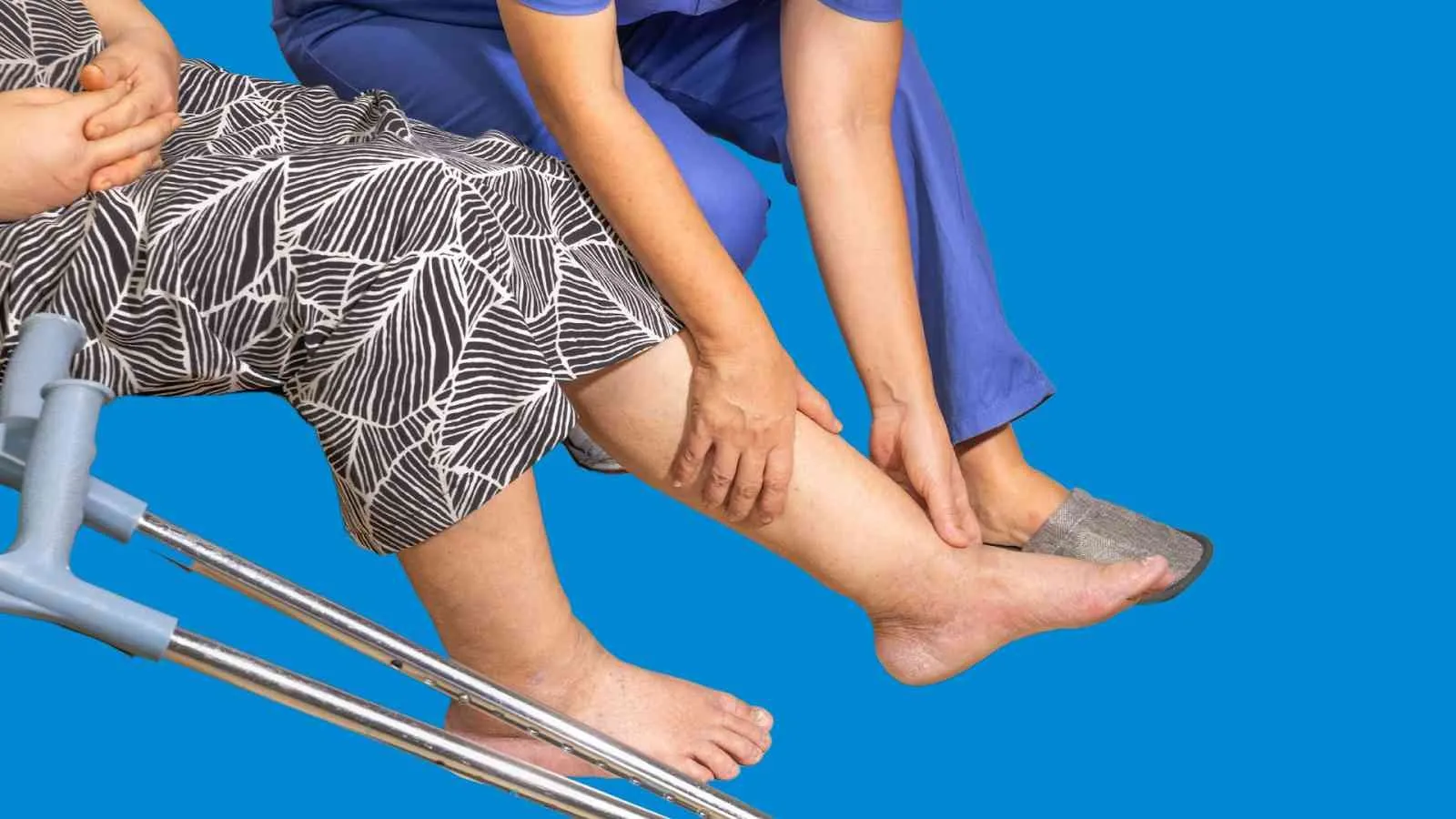Lymphedema: Everything You Need To Know - Rosen Vein Care